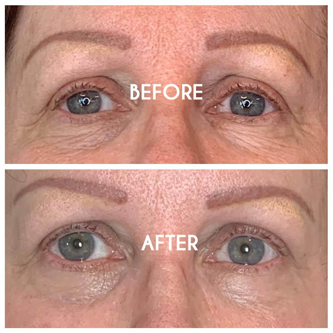 MedSpa Specials | Orange County & Riverside | AesthetiCare